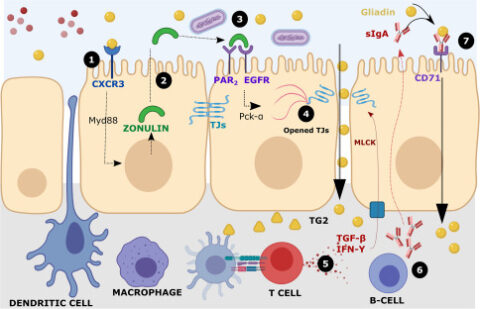 GI-MAP® with Zonulin Test | Gut Health & Leaky Gut Insights